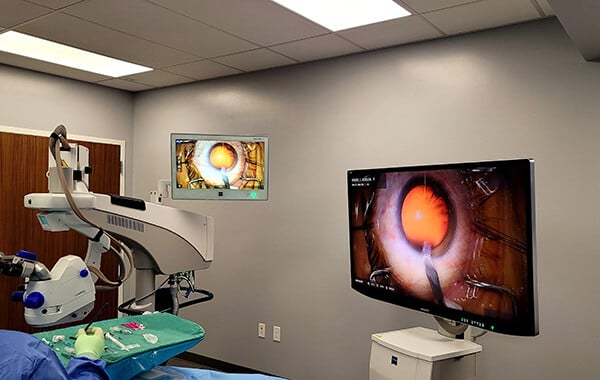 The Future of Cataract Surgery